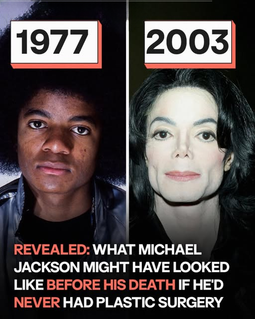 How Michael Jackson Could Have Aged Naturally Without Plastic Surgery ...