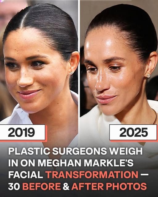 From ‘Ugly Duckling’ to Global Icon: Meghan Markle’s Stunning ...