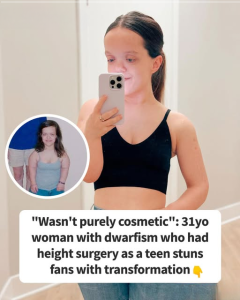 From 4’3″ to 4’11”: 31-Year-Old Chandler Crews Reveals Her Limb ...